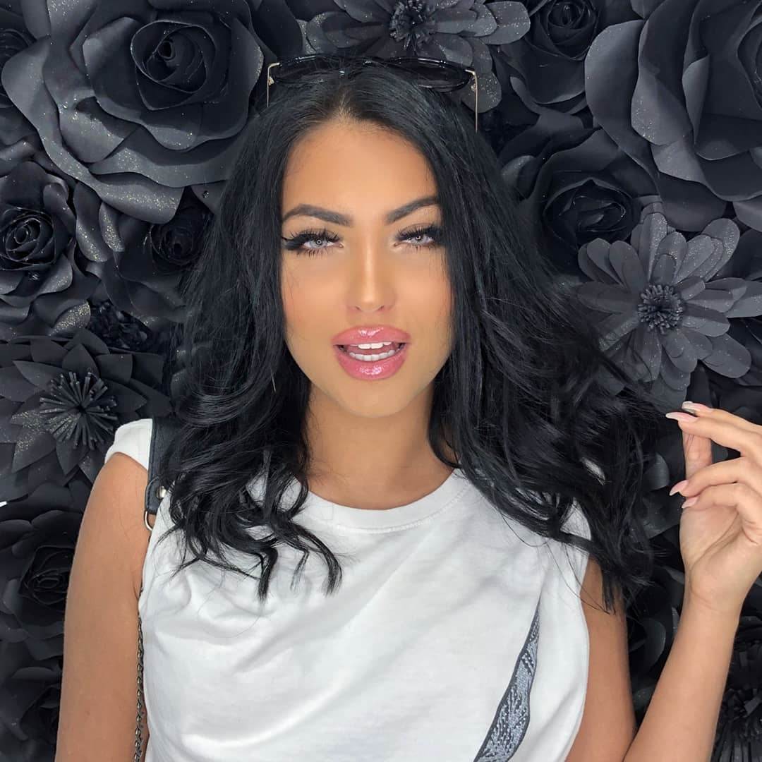 NAKON OPERACIJE Hana Rodić pokazala grudi | Story