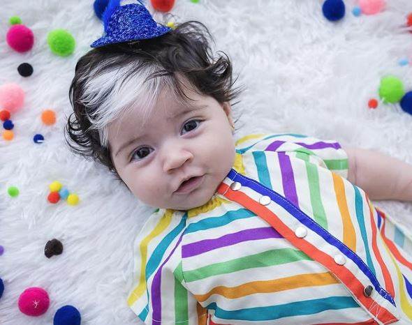 Kako danas izgleda djevojcica rodena s bijelim pramenom kose? | Story