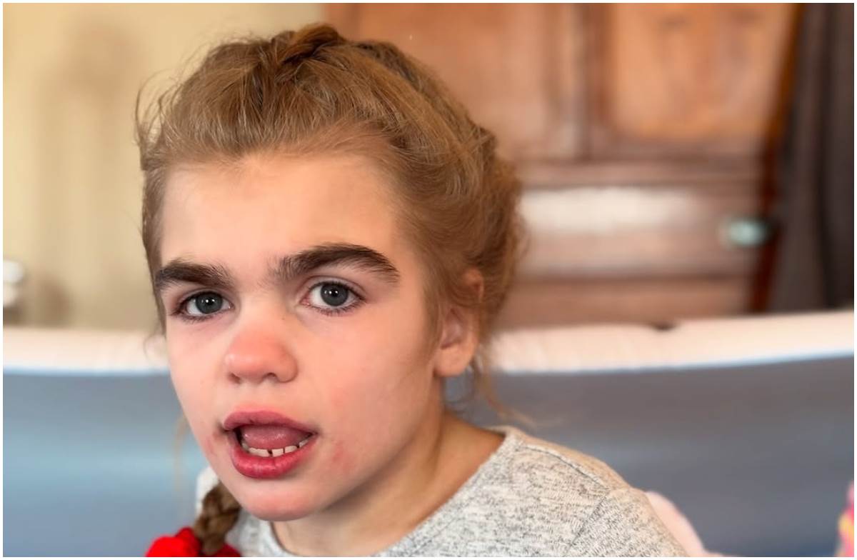 Kcerine debele obrve simptom djecje demencije | Story TV